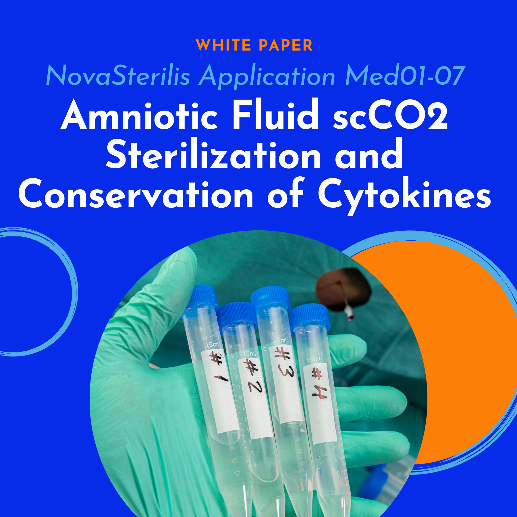 Amniotic Fluid scCO2 Sterilization & Conservation of Cytokines