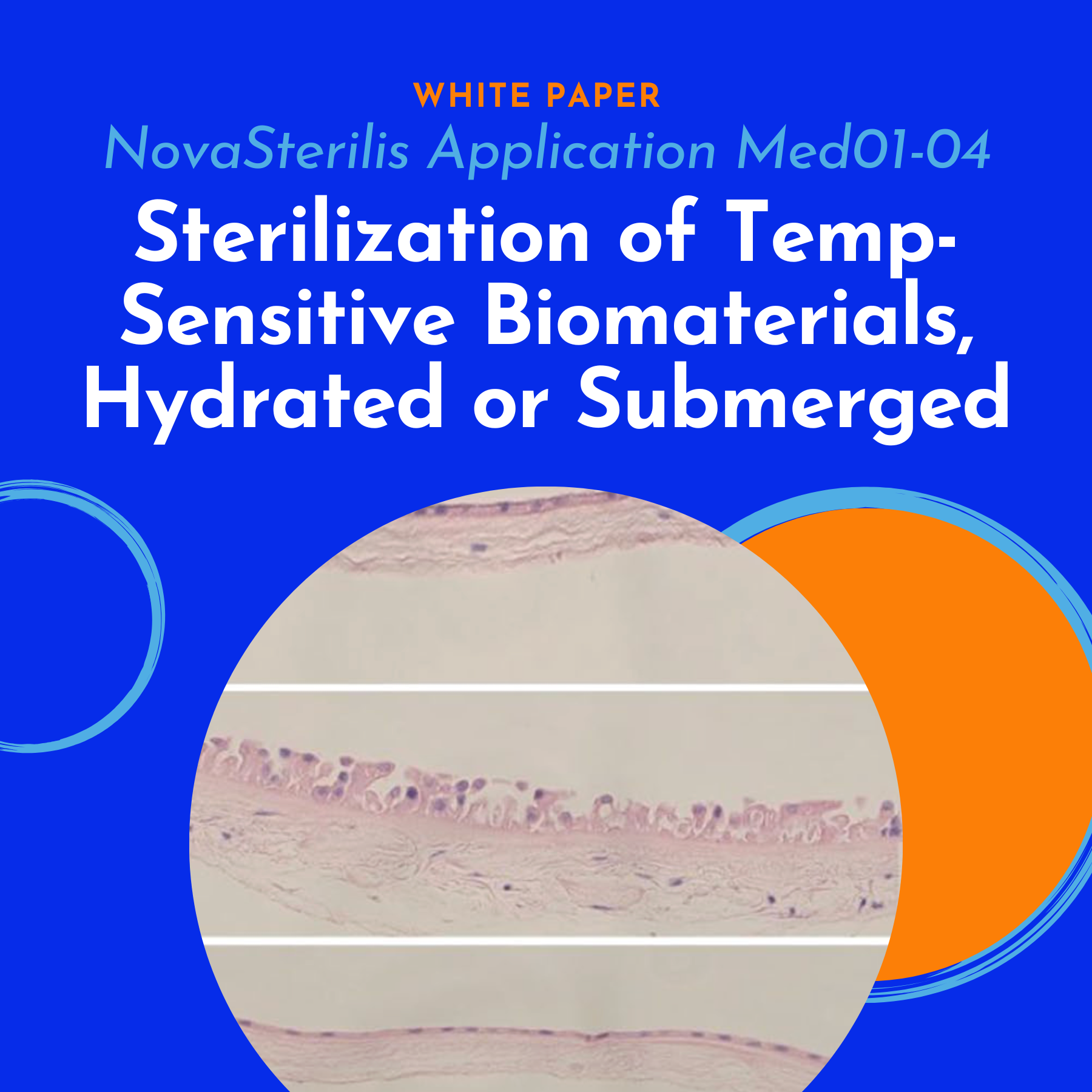 Sterilization of Temperature-Sensitive Biomaterials | White Paper